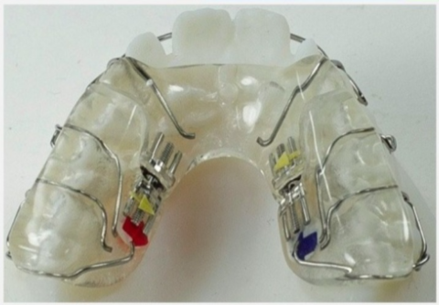 Facial Orthopedics & Controlled Arch Orthodontics - Grande Prairie ...